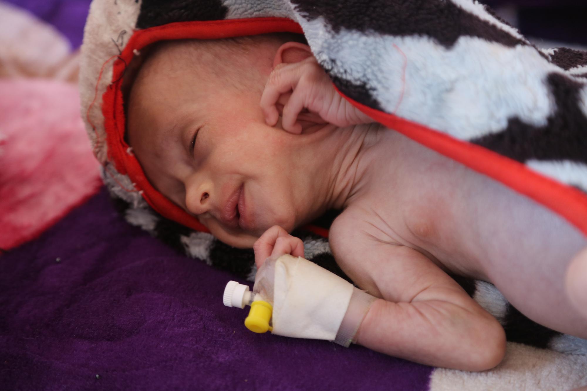 Children Are the Hidden Victims of Hunger and War. Here Are Some of ...