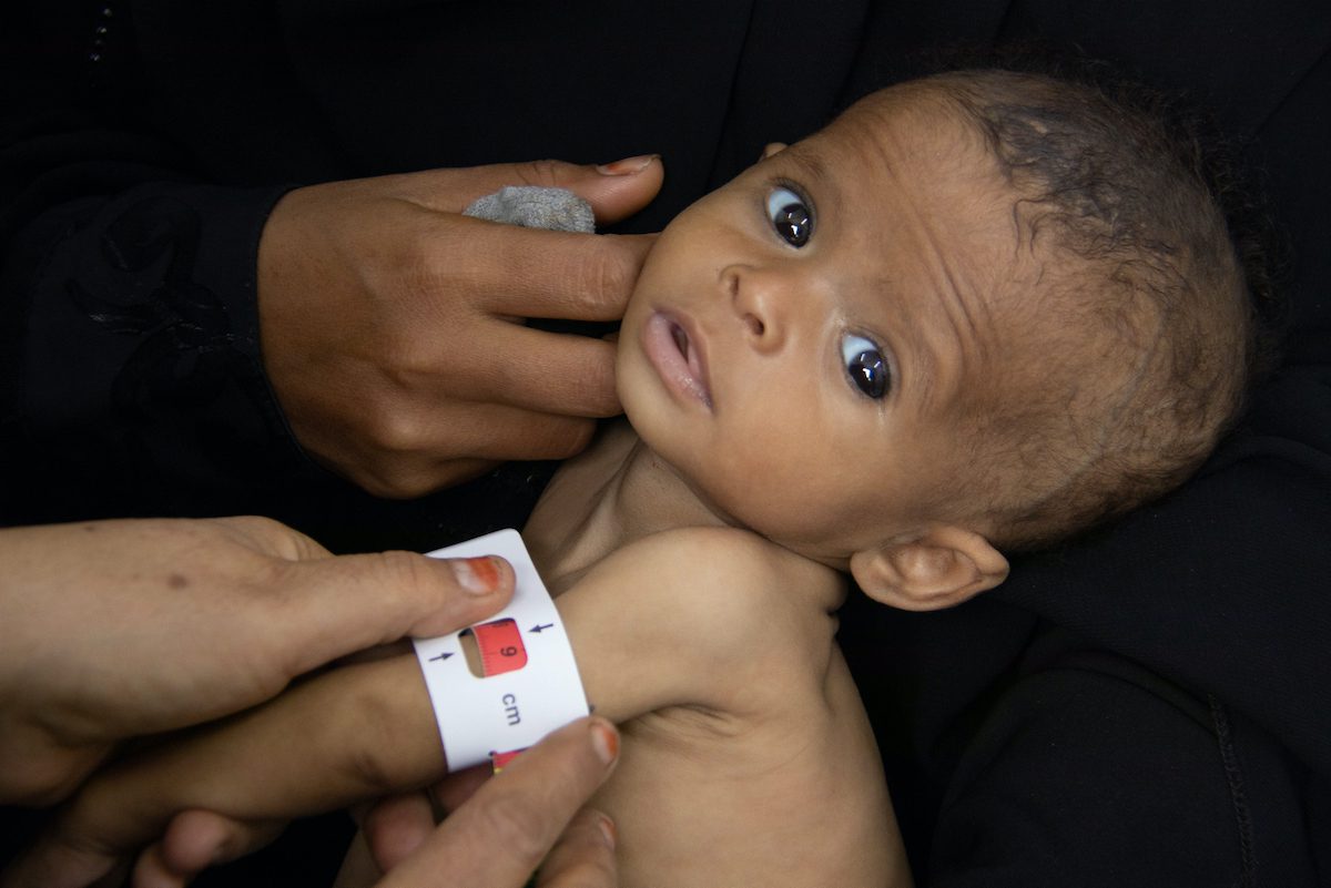 This Is What Extreme Hunger Looks Like Through the Eyes of Seven Small ...